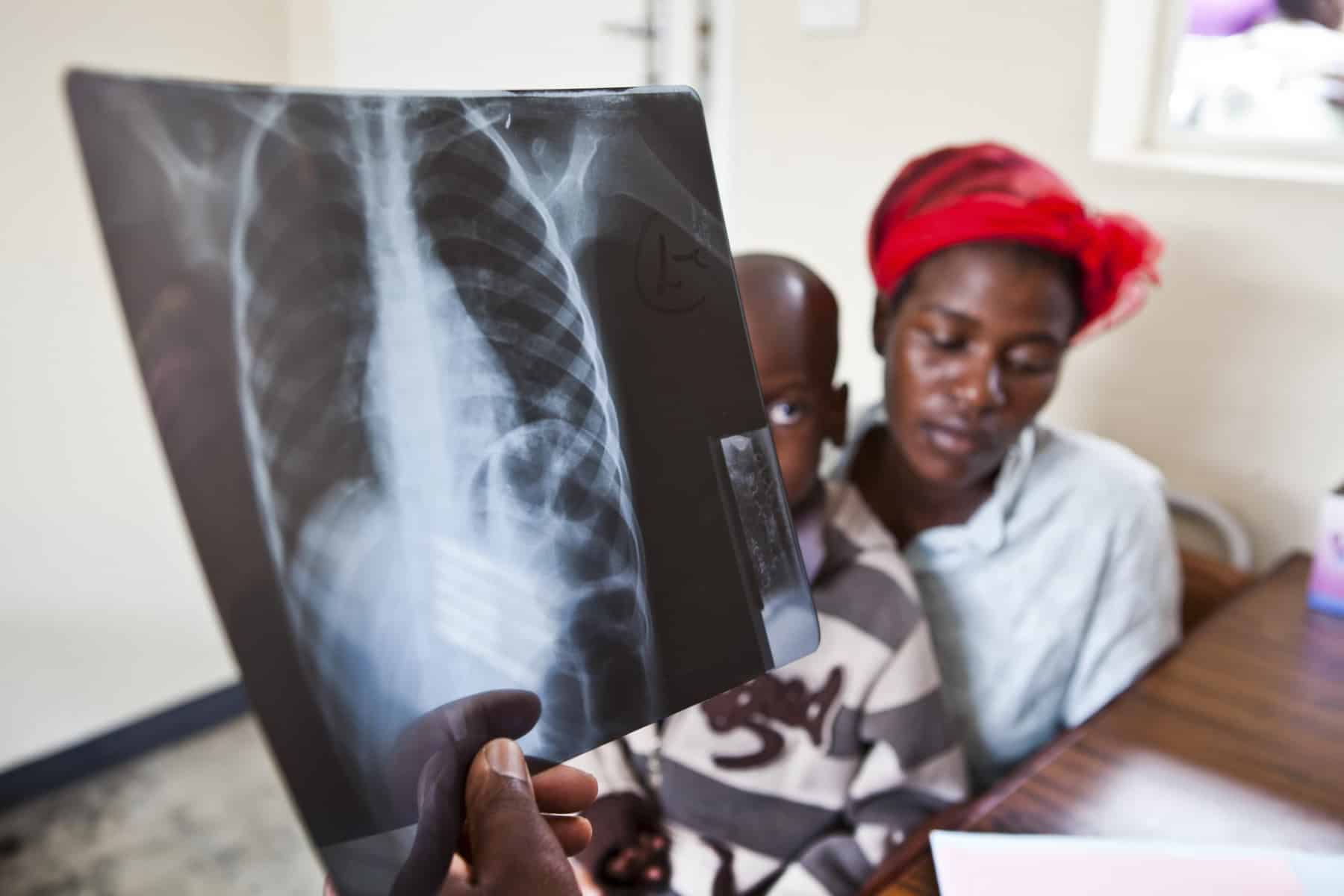 Zimbabwe - Médecins Sans Frontières(MSF)/Doctors Without Borders