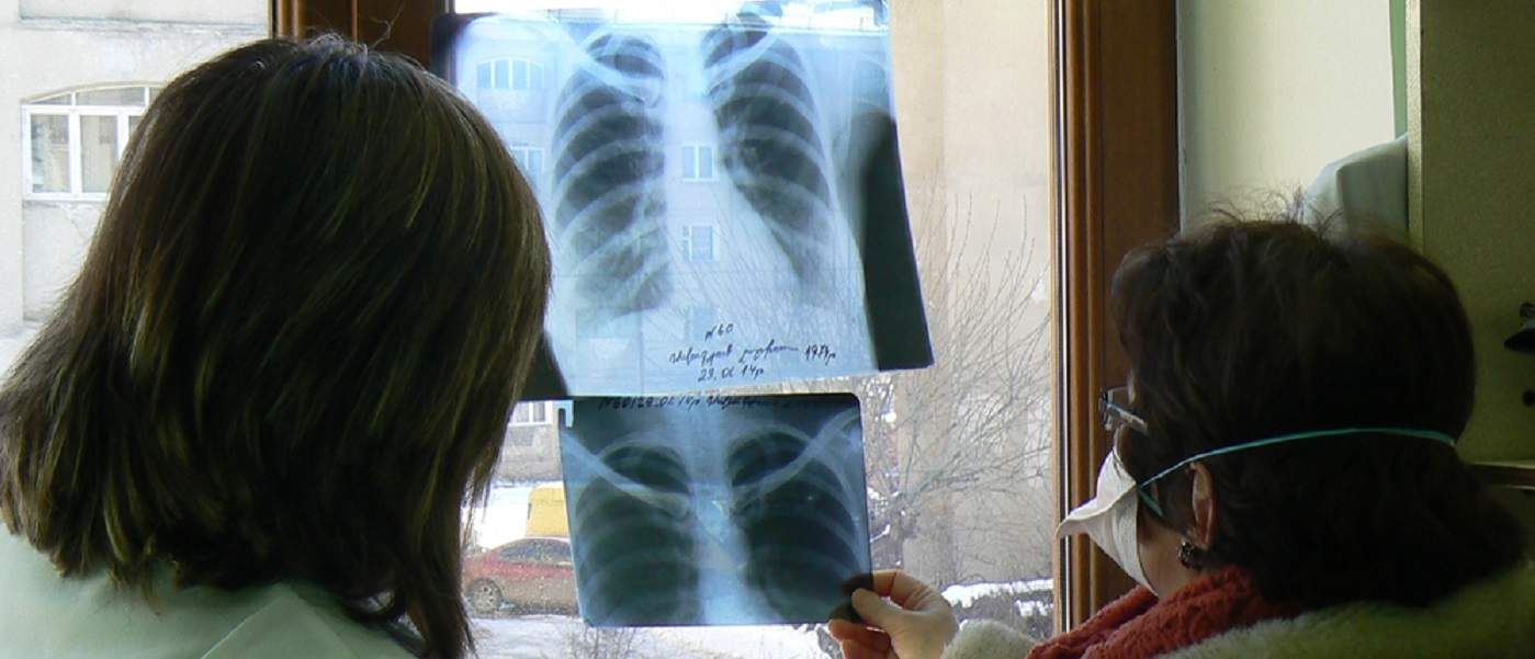 MSF response to WHO TB treatment and diagnostic recommendations ...